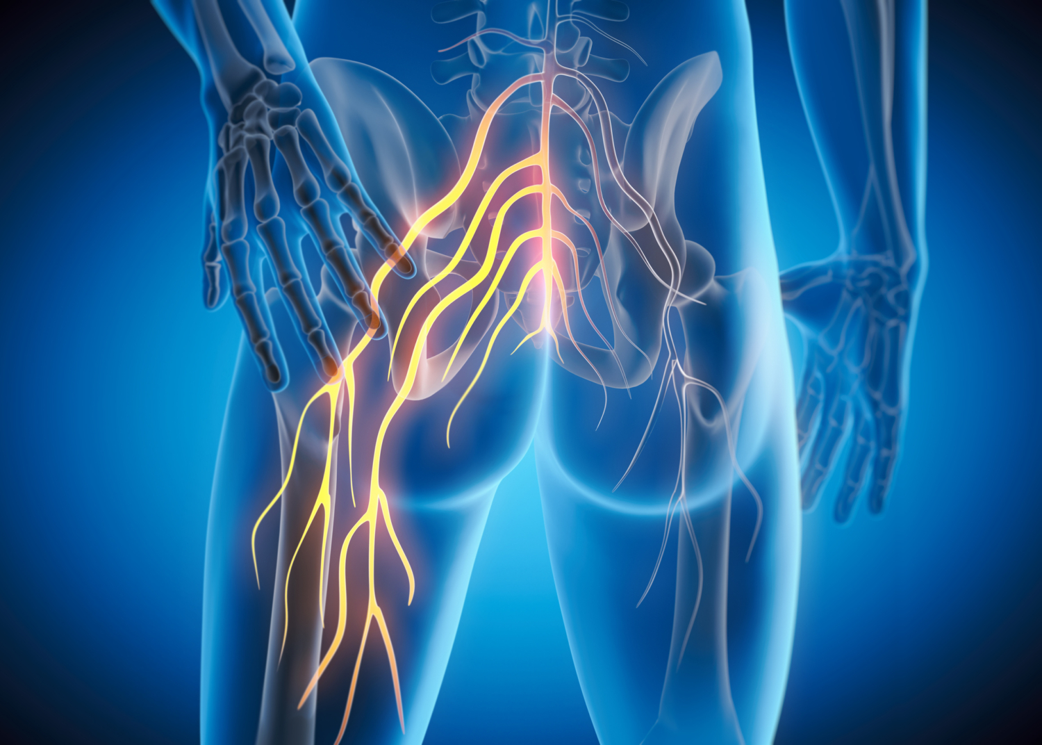 Can an osteopath help sciatica pain? | Therapy for sciatic pain